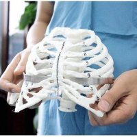 Pectus.com: Community Support and Surgeon Database